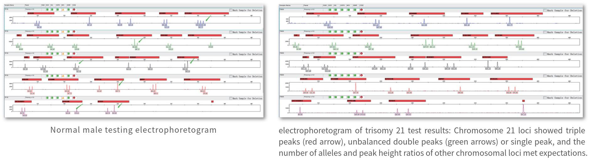 Beijing Microread Genetics Co., Ltd.